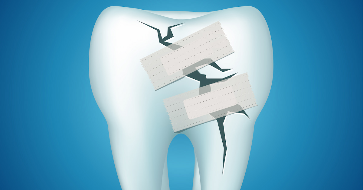 Easy Steps to Handle a Broken Tooth
