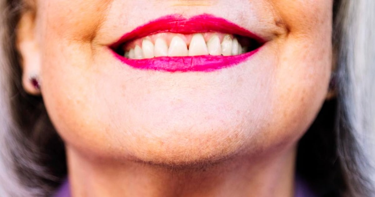 Flexible Partial Denture for Upper Front Teeth - The Best Choice